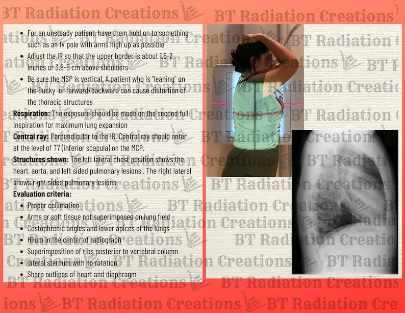 Study Guide, Chest X-ray, Chest Radiograph, Positioning and Procedures ...