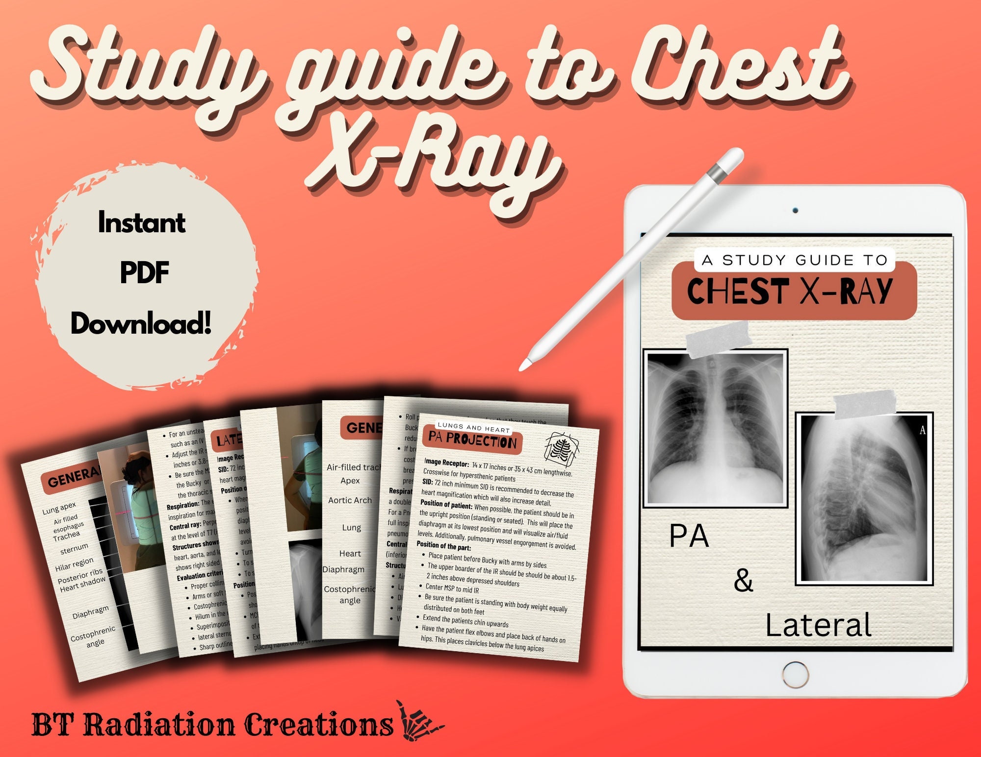 Study Guide, Chest X-ray, Chest Radiograph, Positioning and Procedures, PDF Download, X-ray Tech ...