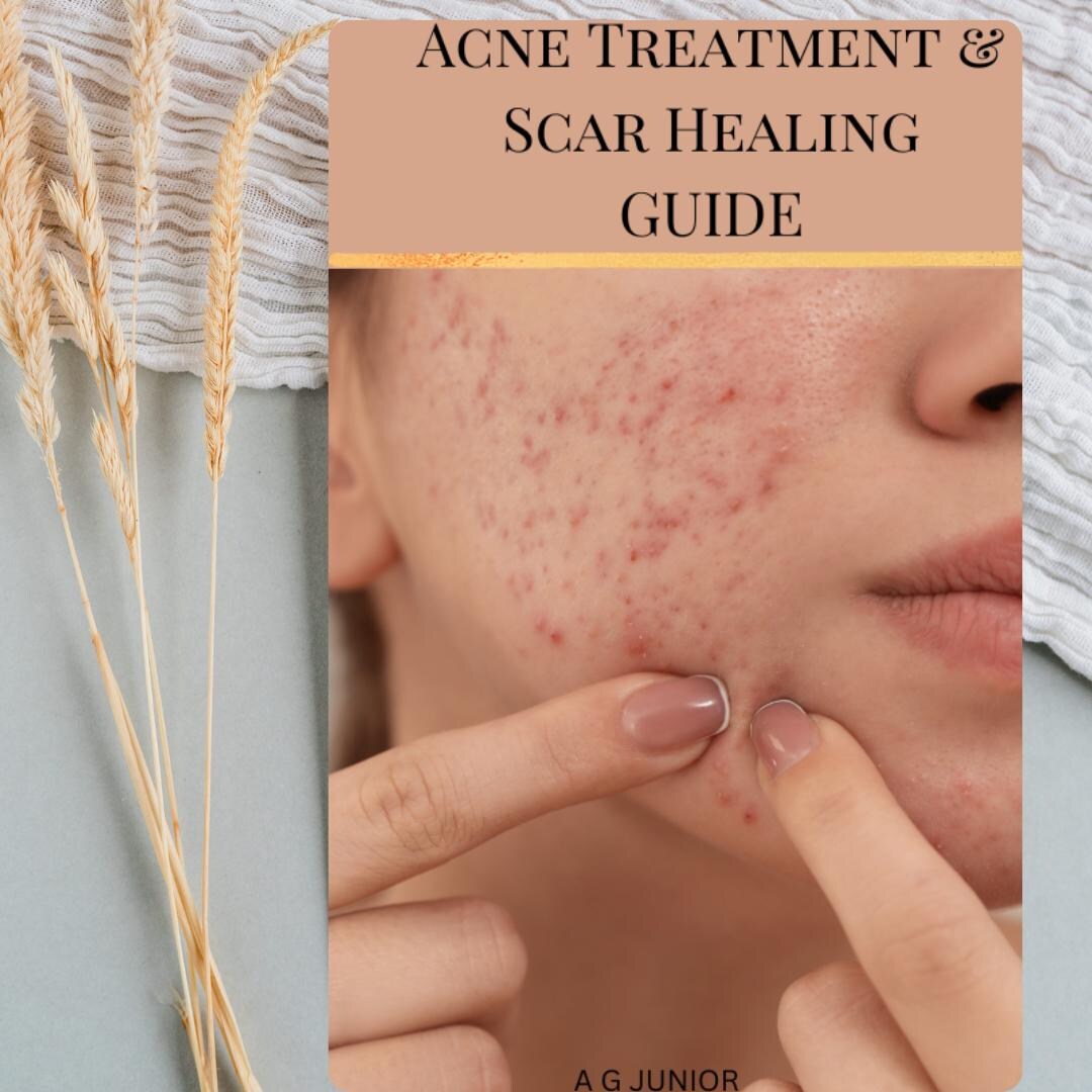 Acne Treatment & Scar Healing Guide Skincare Routine for Clear Skin - Etsy