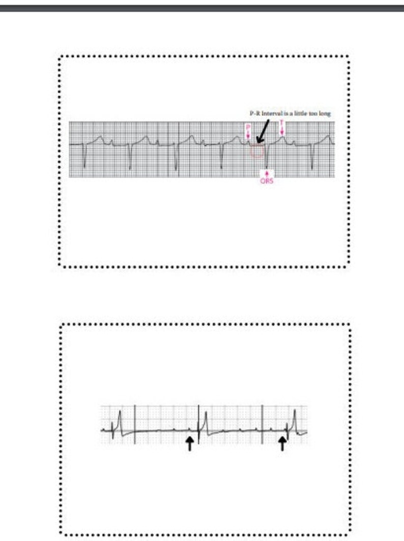 Vet Reference ECG Vet Tech Pocket Guide ECG Reference EKG - Etsy