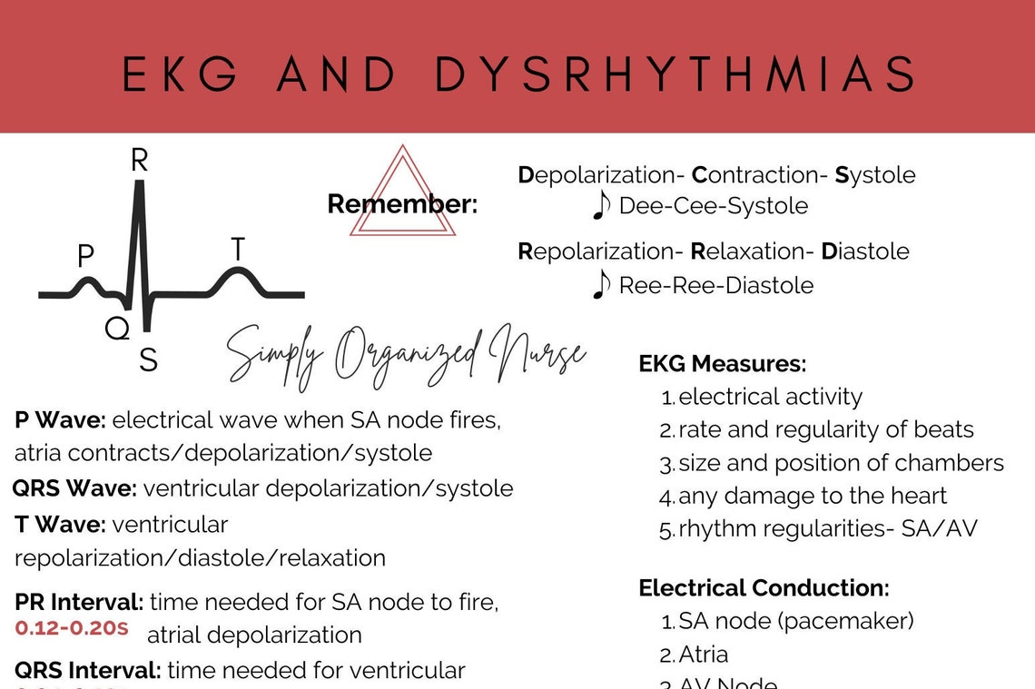 EKG and Dysrhythmia Overview for Nurses - Etsy