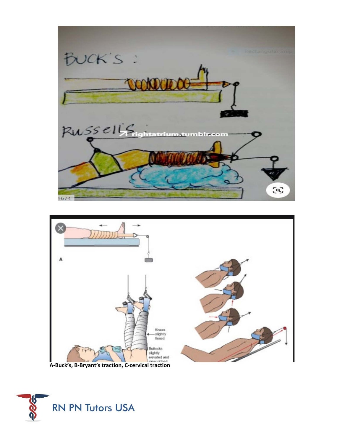 Musculoskeletal Sensory Disorders Study Guide Bundle for NCLEX, Medical ...