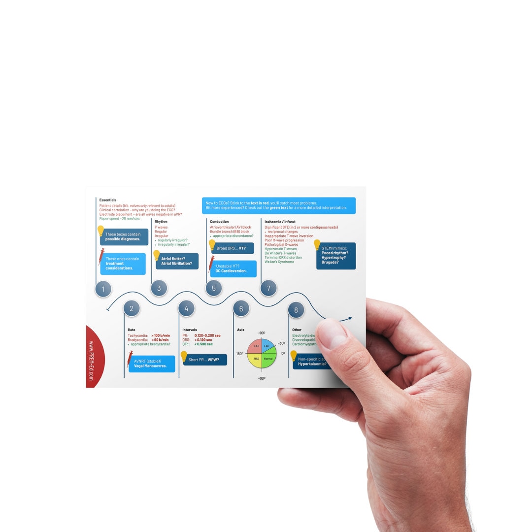 ECG Interpretation Card - Etsy