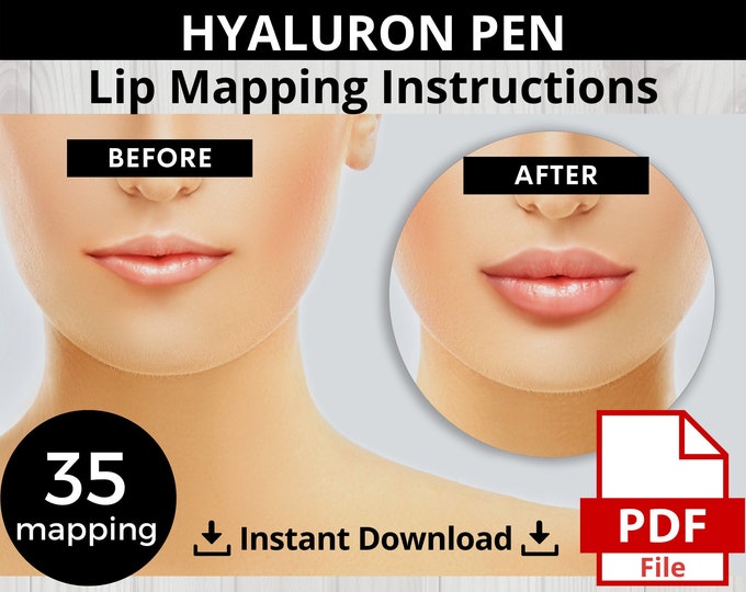 Hyaluron Pen Lip Mapping Lip Map Lip Mapping Techniques - Etsy New Zealand