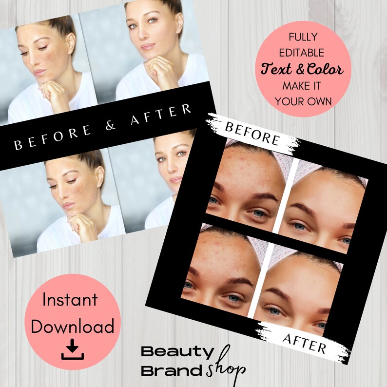 Skincare Before and After Templates Editable Esthetician - Etsy