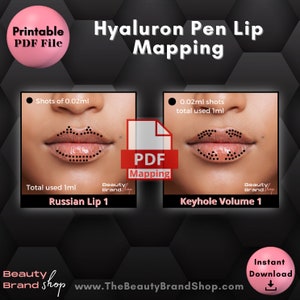 Lip Mapping, Hyaluron Pen Lip Mapping, Lip Map, Lip Blush Mapping, Lip ...