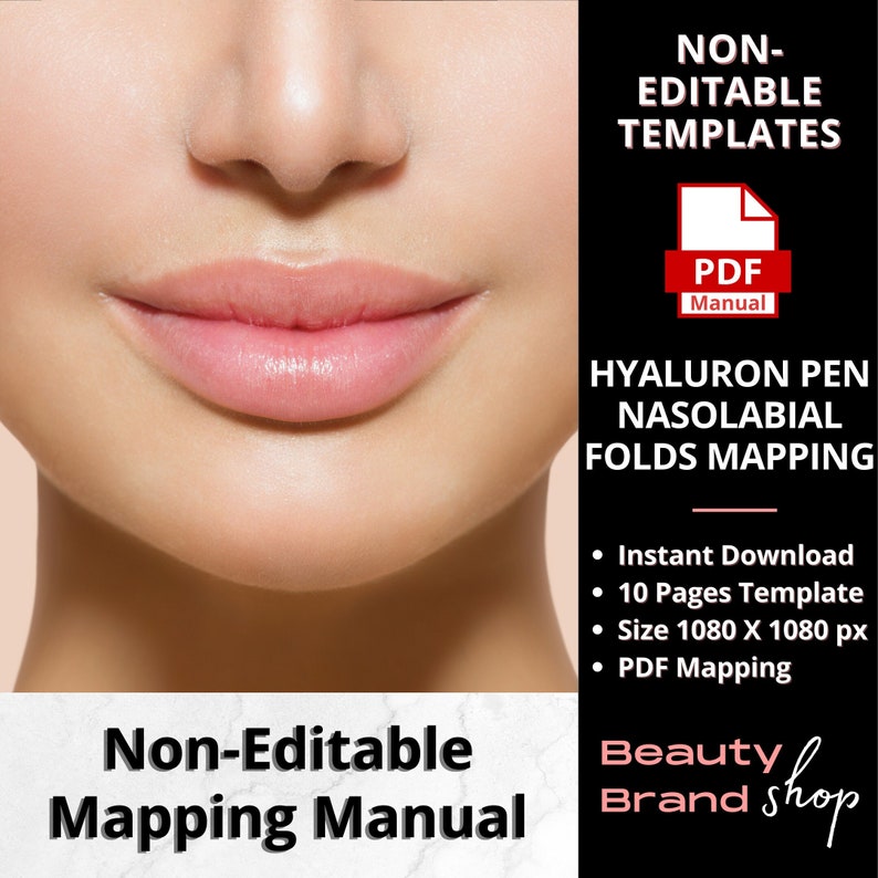 Hyaluron Pen Nasolabial Folds Mapping, Nasolabial Fold Fillers Technique, Smile Lines Mapping ...