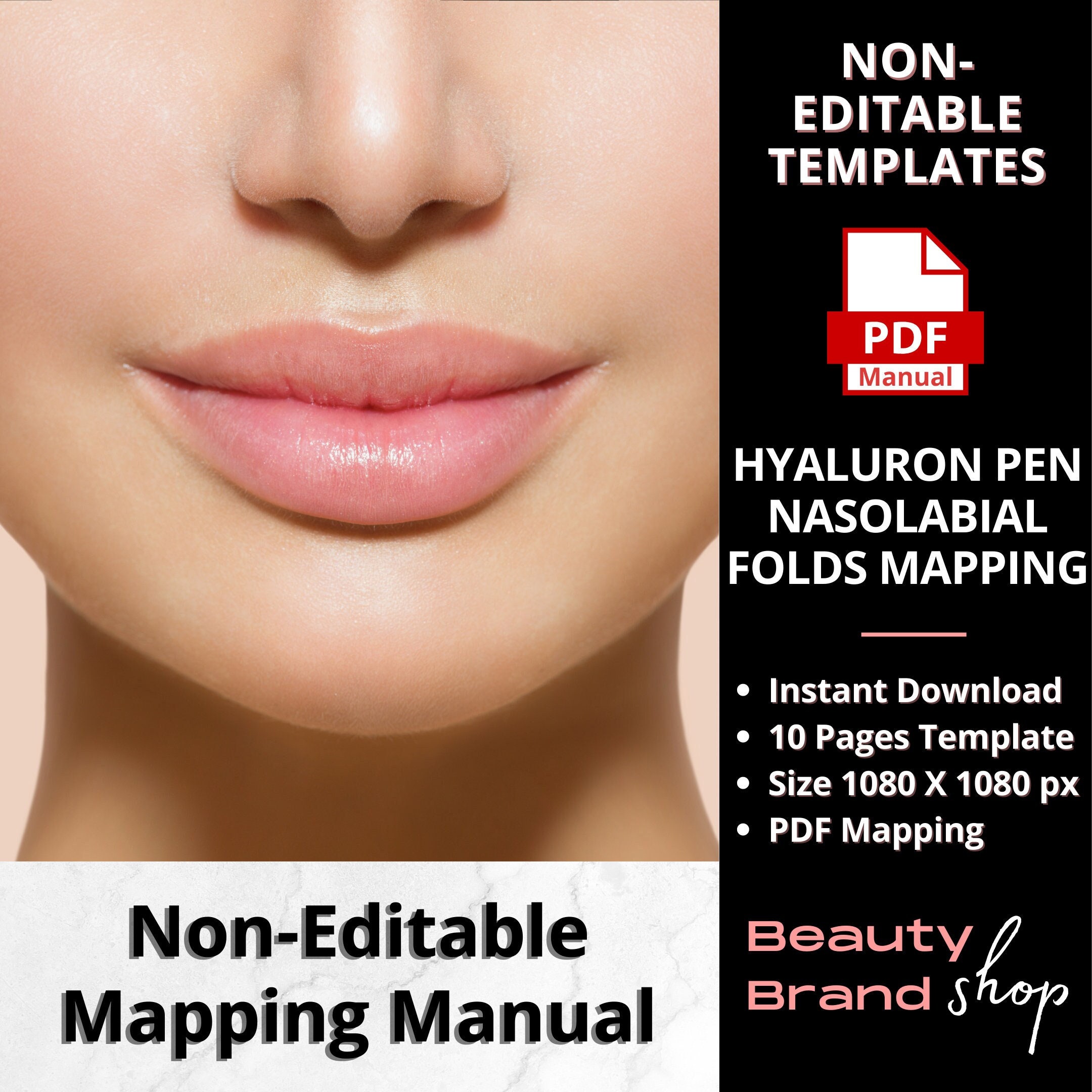 Hyaluron Pen Nasolabial Folds Mapping, Nasolabial Fold Fillers ...