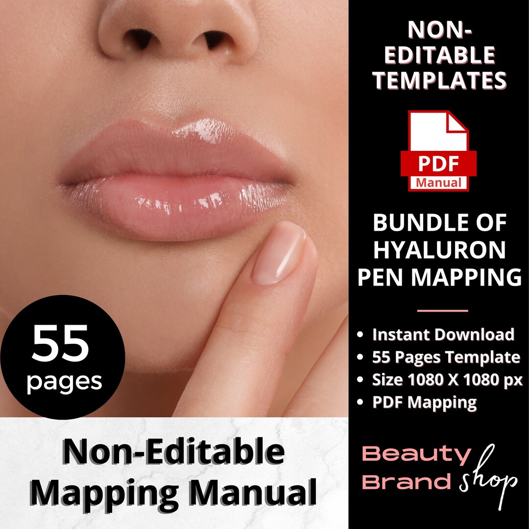 Hyaluron Pen Mapping, Lip Mapping, Nasolabial Folds Mapping, Marionette ...
