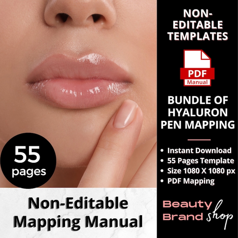Hyaluron Pen Mapping, Lip Mapping, Nasolabial Folds Mapping, Marionette ...