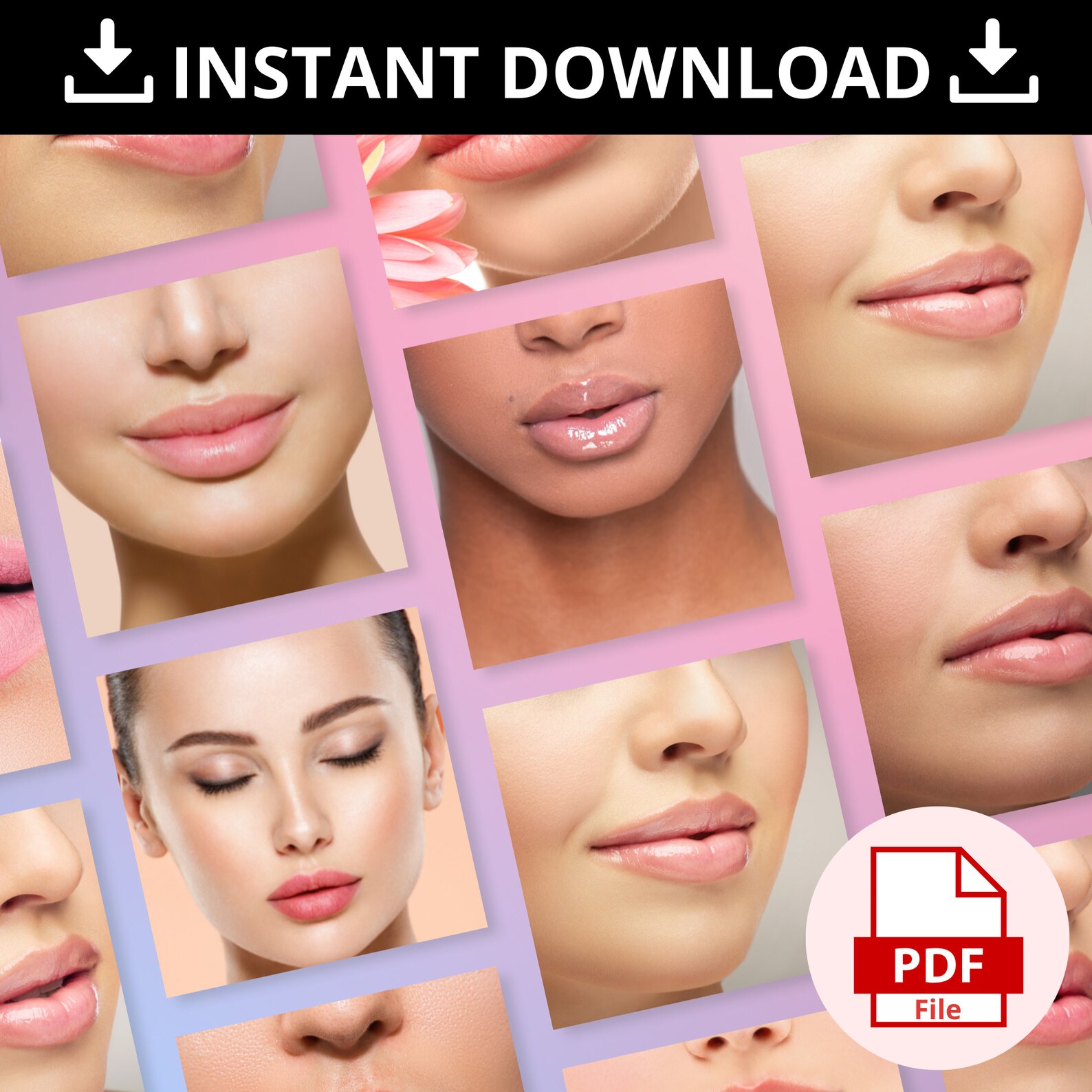 Hyaluron Pen Nasolabial Folds Mapping, Nasolabial Fold Fillers ...