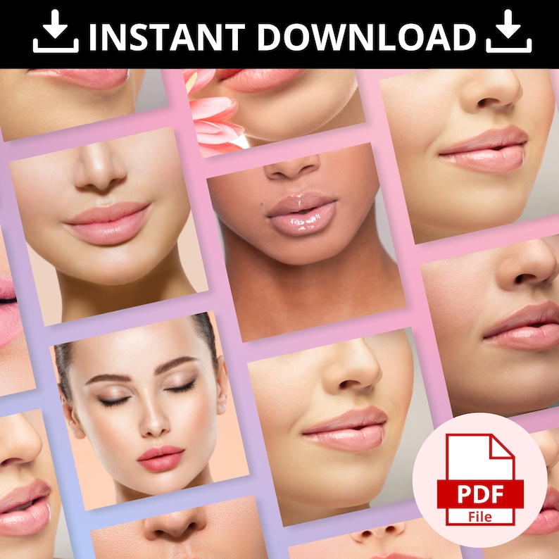 Hyaluron Pen Nasolabial Folds Mapping, Nasolabial Fold Fillers ...