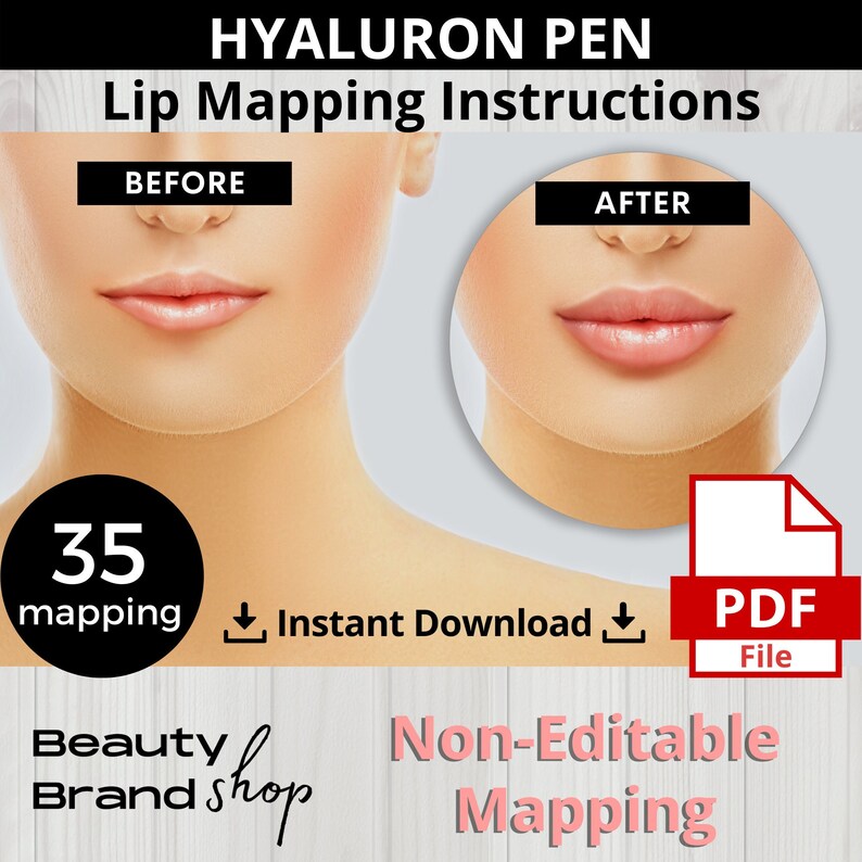 Hyaluron Pen Lip Mapping Lip Map Lip Mapping Techniques - Etsy