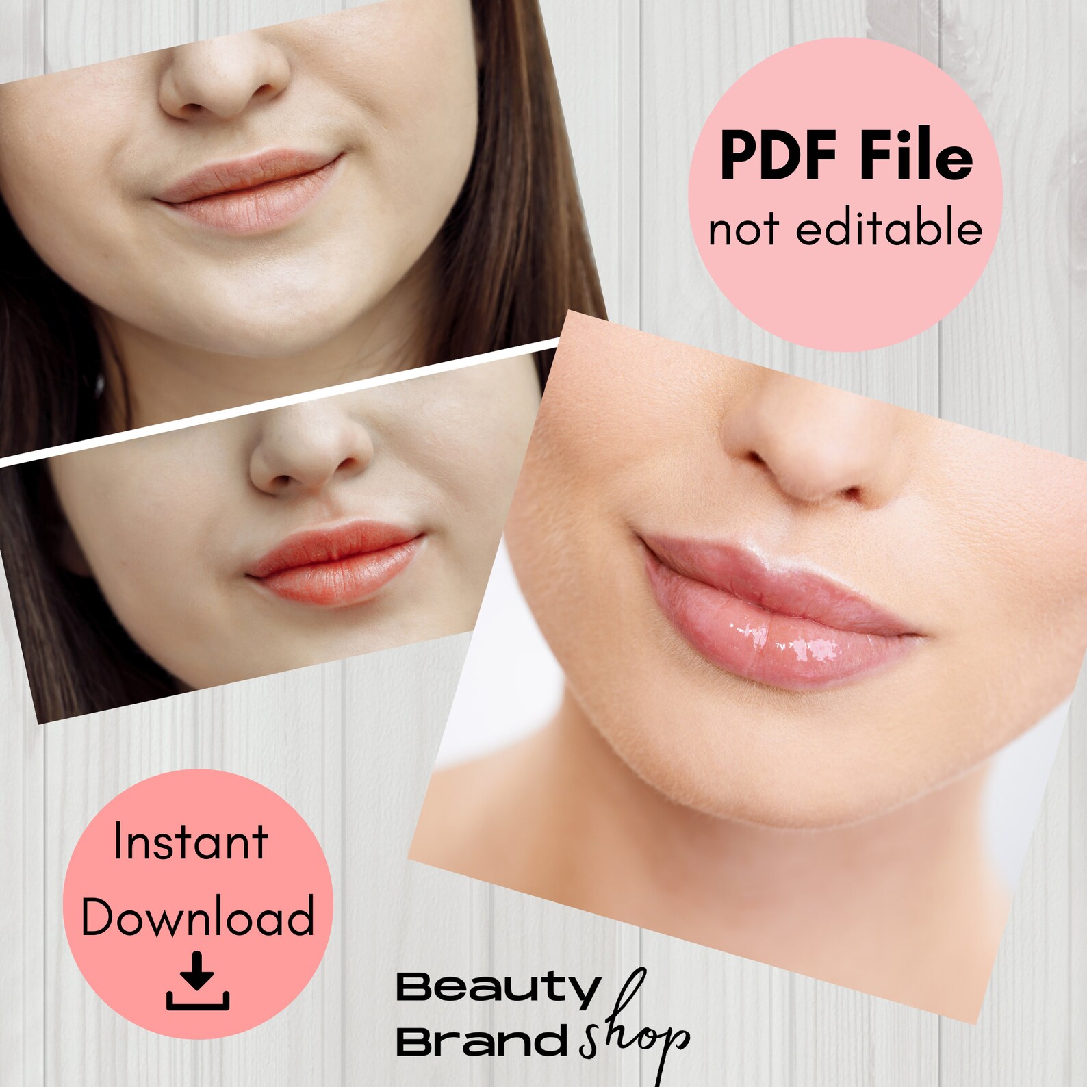 Hyaluron Pen Nasolabial Folds Mapping, Nasolabial Fold Fillers ...