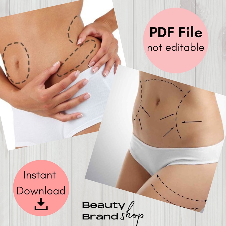 Fat Dissolve Mapping, Fat Dissolving Mapping, Fat Mapping, Hyaluron Pen Mapping, Fat Dissolving ...