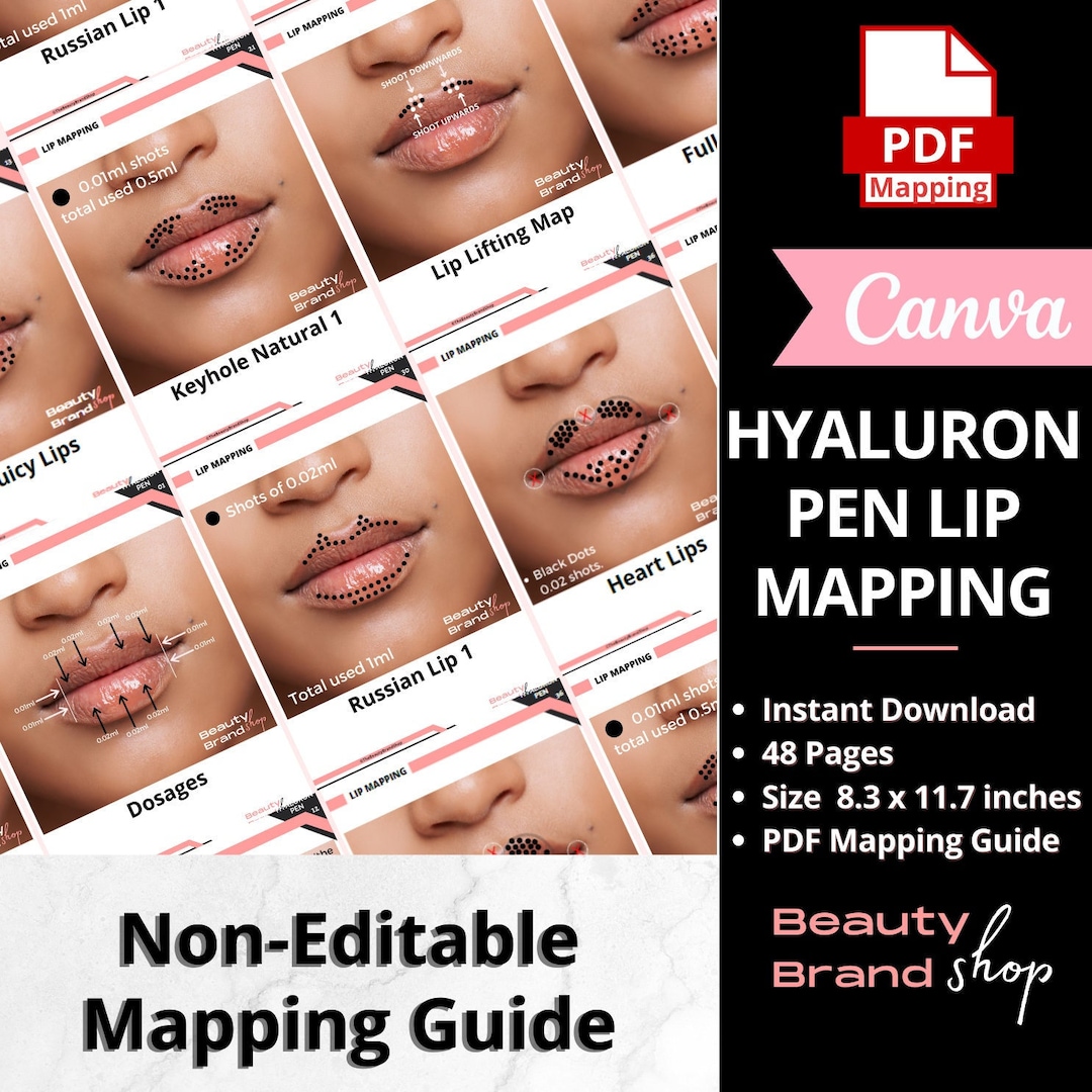 Hyaluron Pen Lip Mapping Training, No Needle Lips, Lip Map, Cupid Bow ...