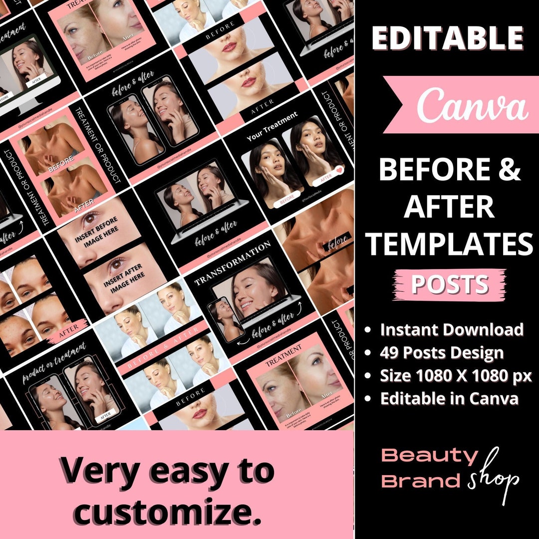 Editable Skincare Before and After Templates, Esthetician Instagram ...