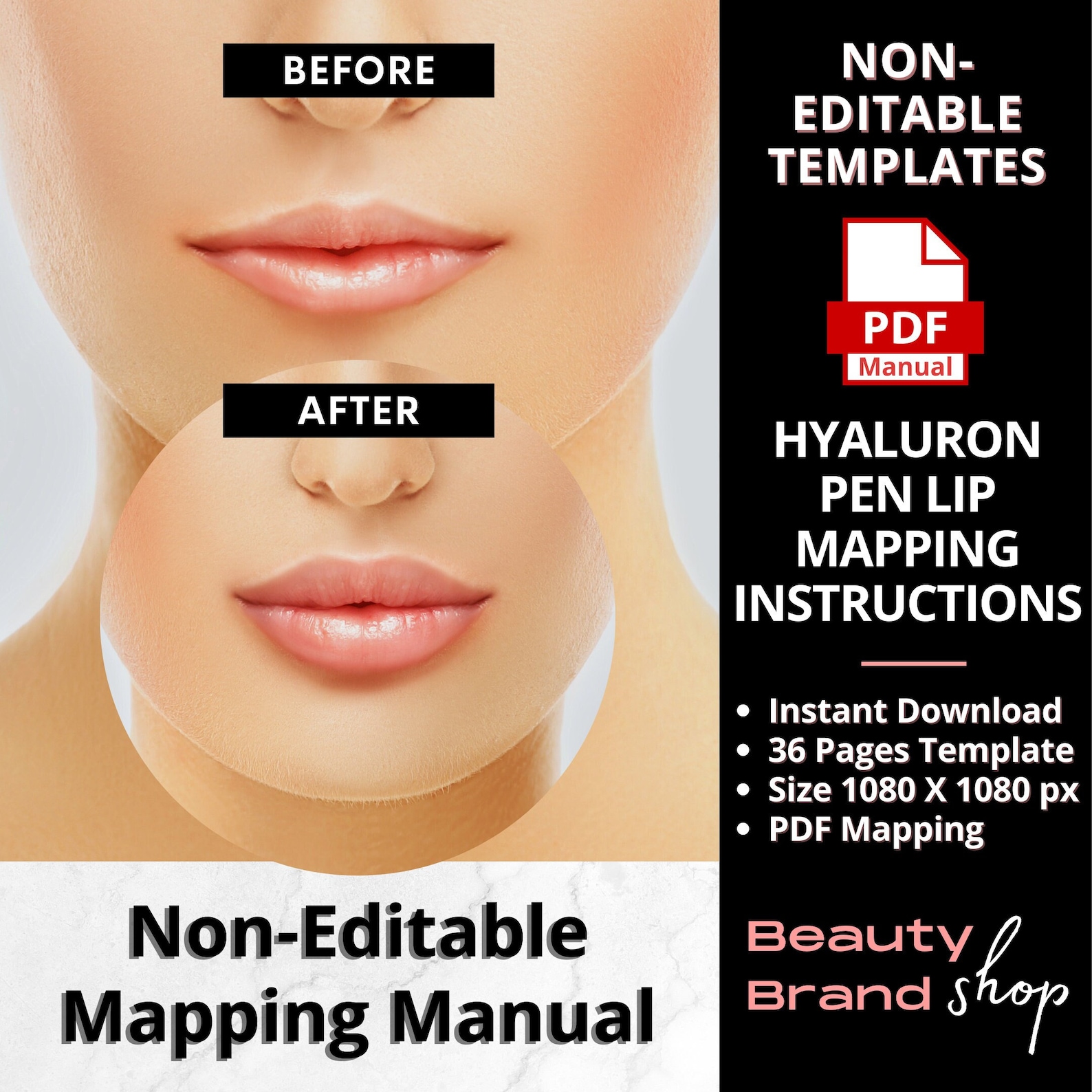 Hyaluron Pen Lip Mapping Lip Map Lip Mapping Techniques - Etsy