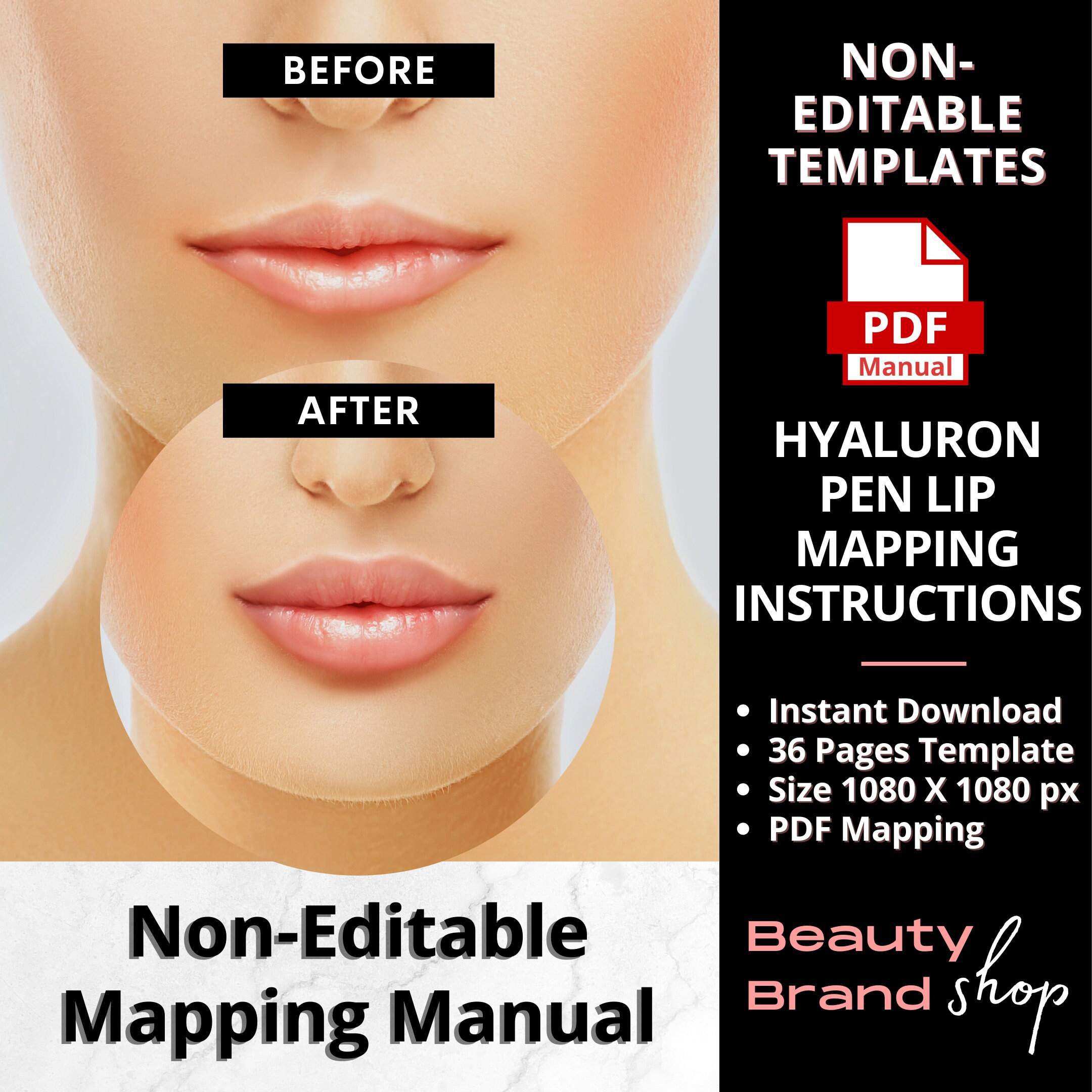 Hyaluron Pen Lip Mapping Lip Map Lip Mapping (Download Now) - Etsy