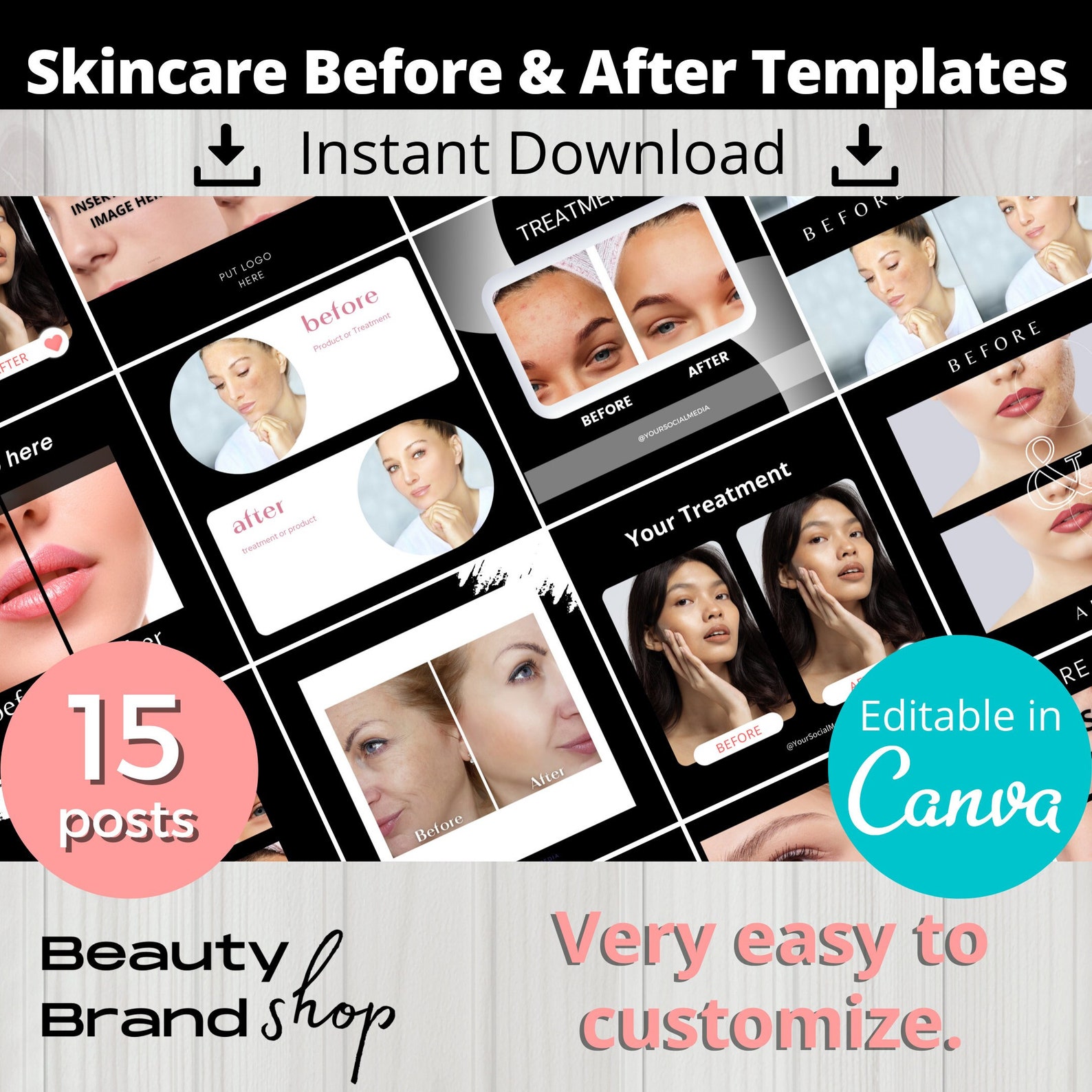 Skincare Before and After Templates Editable Esthetician - Etsy