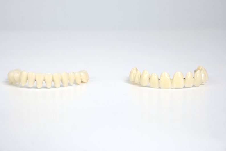 Diy Partial Upper And Lower Custom Partial Dental Impression Etsy 