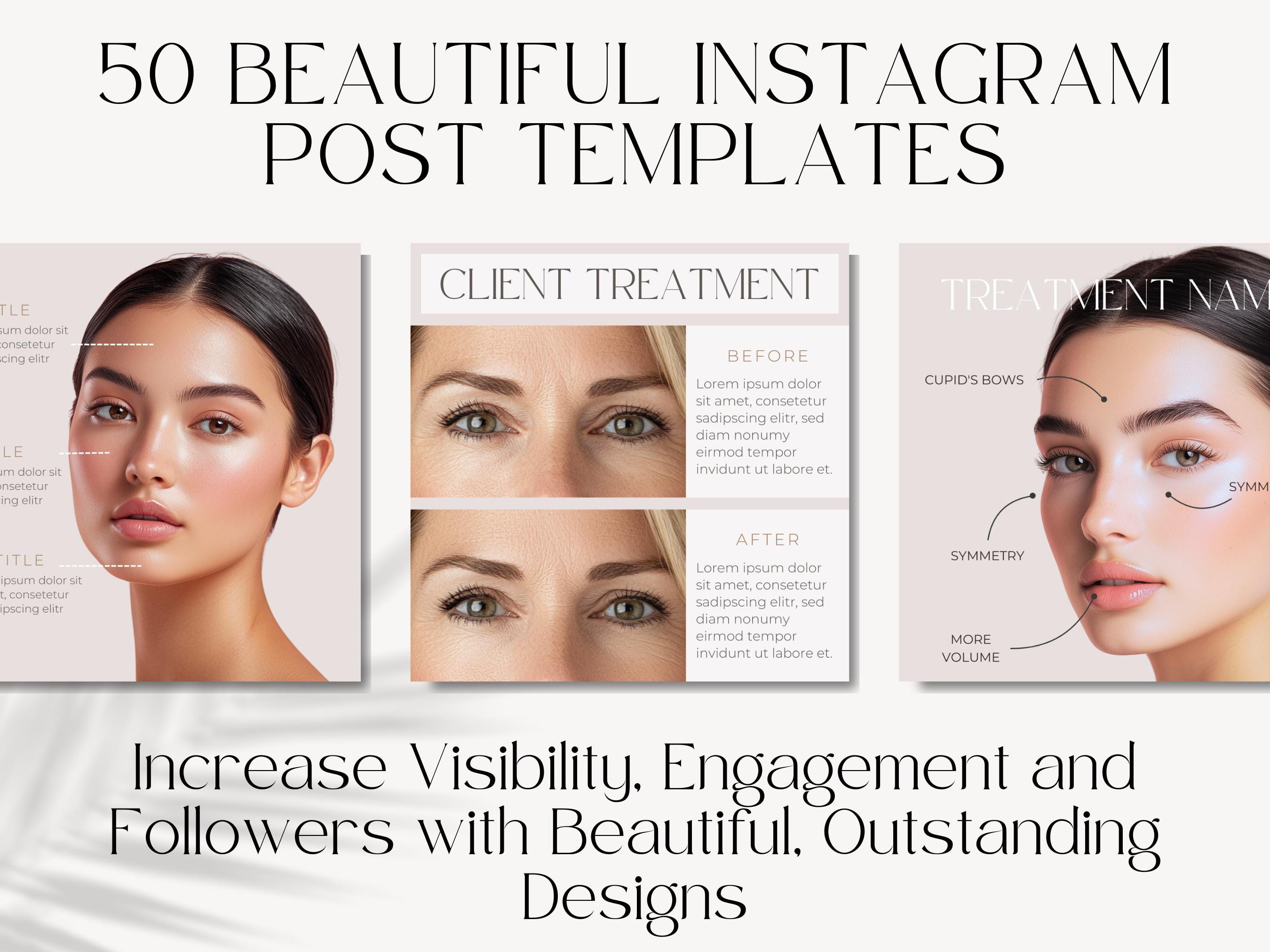 Instagram Templates Botox and Filler Instagram Post Templates Canva ...