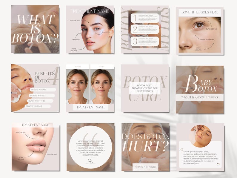 Botox & Filler Instagram Post Templates for Estheticians (canva) - Etsy