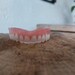Horseshoe Denture Upper - Etsy UK