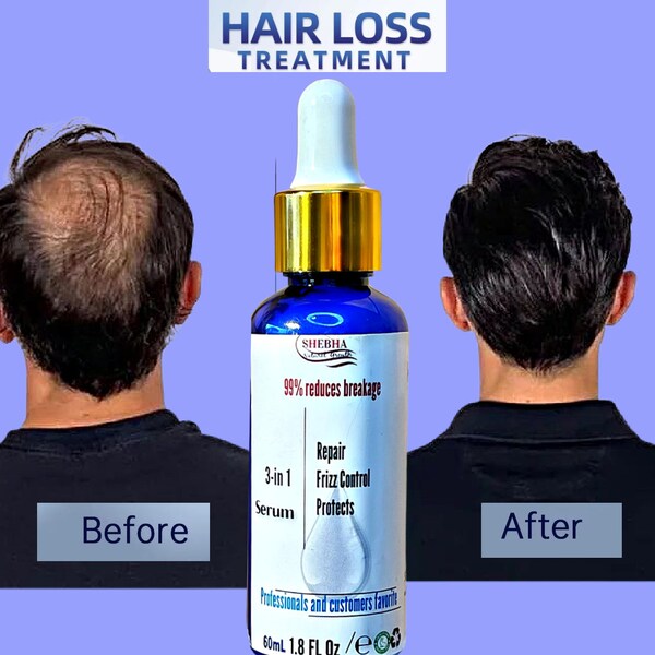 Regrow Hair Etsy