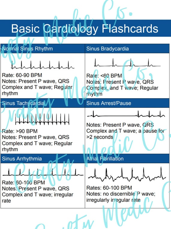 Basic Cardiology Rhythm Flashcards | Etsy
