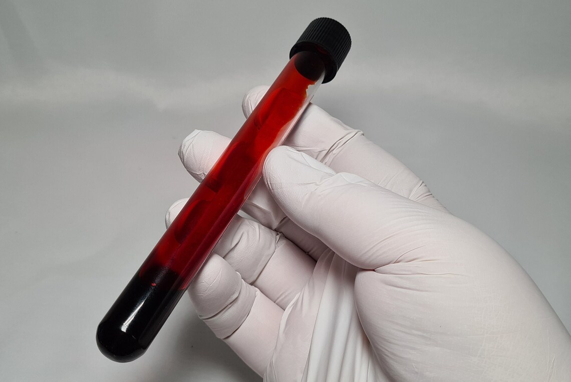 GRE Harran Virus Virus Dying Light Dying Light 2 - Etsy