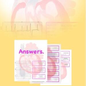 Ventricular Arrhythmia Practice Quiz 1.0: EKG MASTERY for Nurses - Etsy