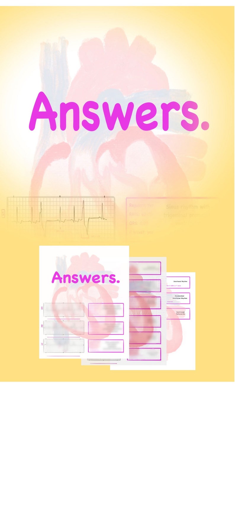 Ventricular Arrhythmia Practice Quiz 1.0: EKG MASTERY for Nurses - Etsy
