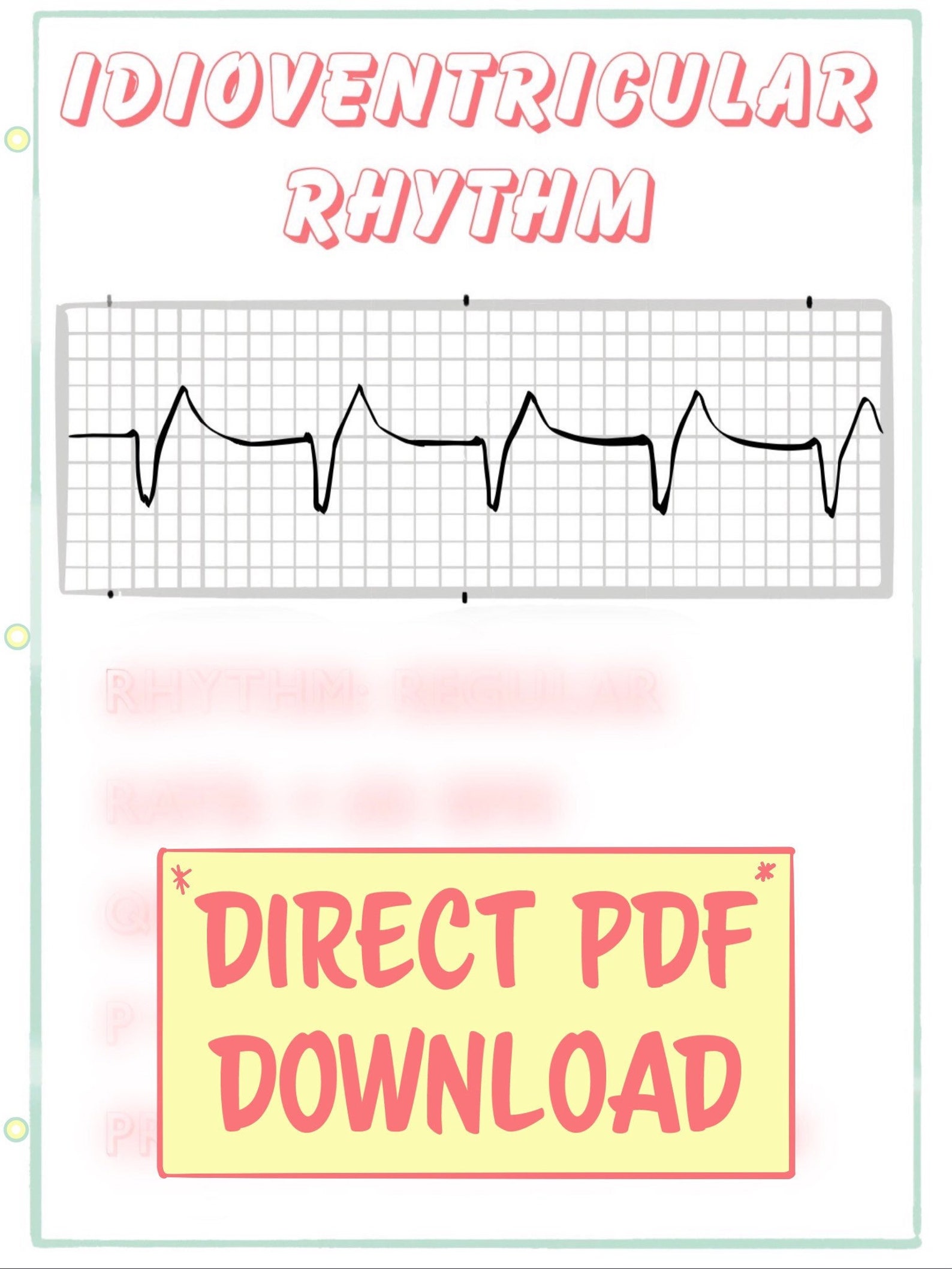 Idioventricular Rhythm ECG Guide: PDF Study Guide - Etsy