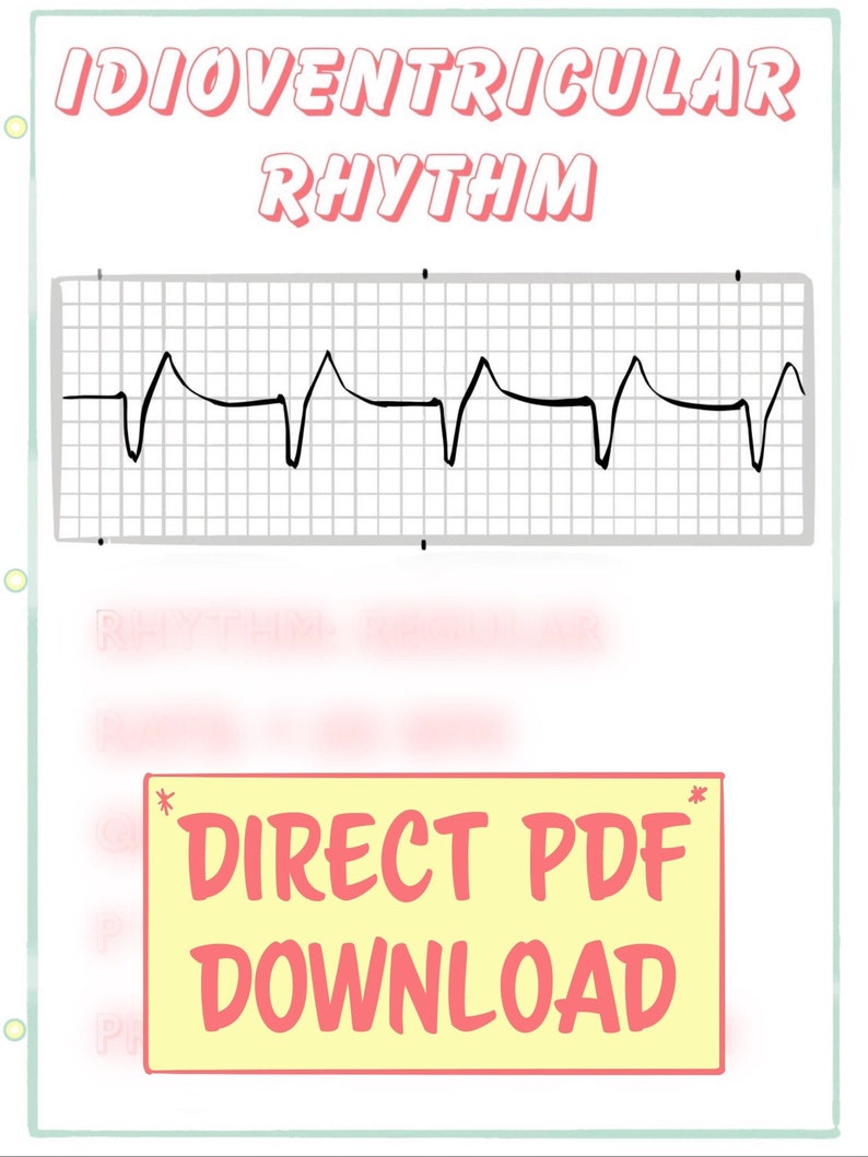 Idioventricular Rhythm ECG Guide: PDF Study Guide - Etsy