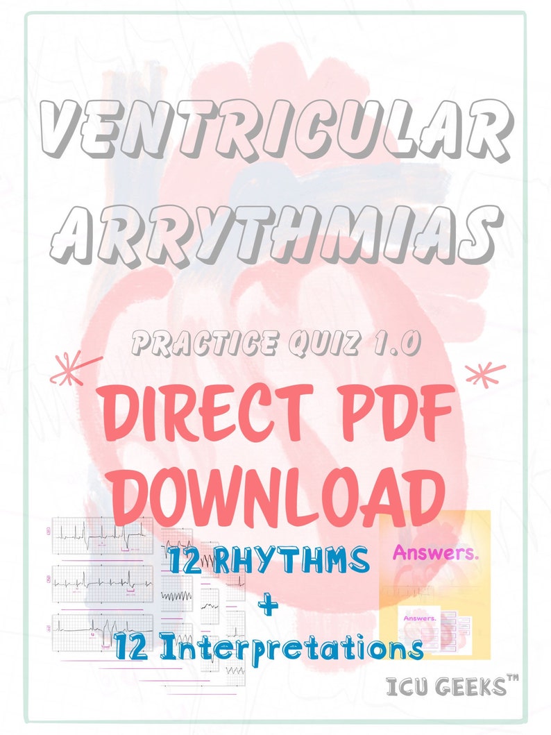 Ventricular Arrhythmia Practice Quiz 1.0: EKG MASTERY for Nurses - Etsy