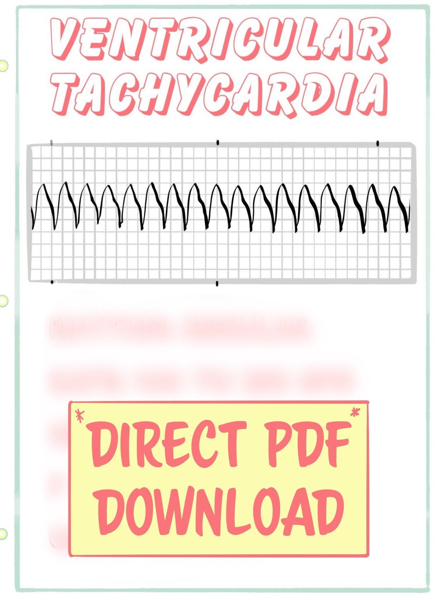 Ventricular Tachycardia Pocket Guide: PDF - Etsy