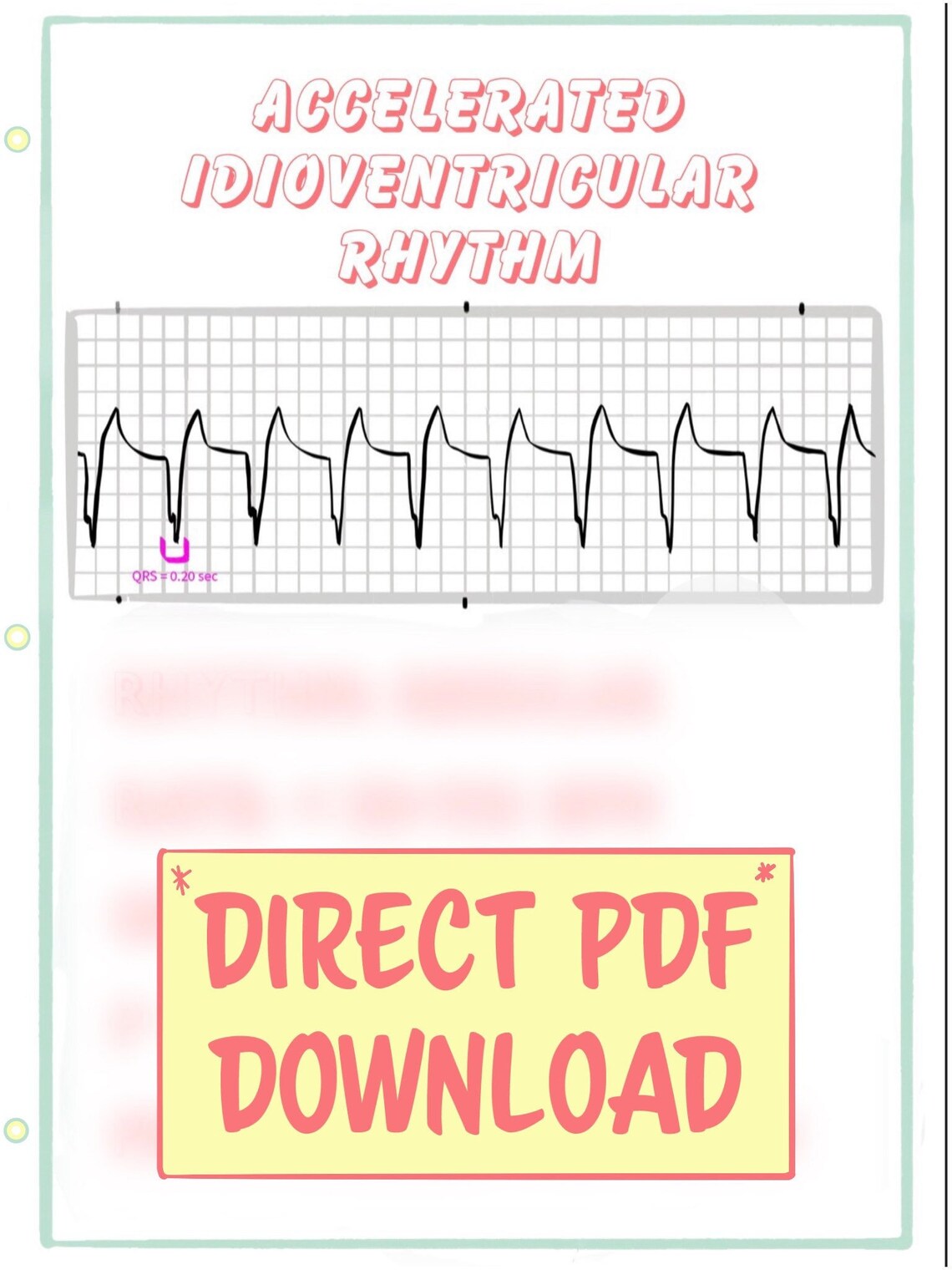 Accelerated Idioventricular Rhythm: PDF Pocket Guide - Etsy