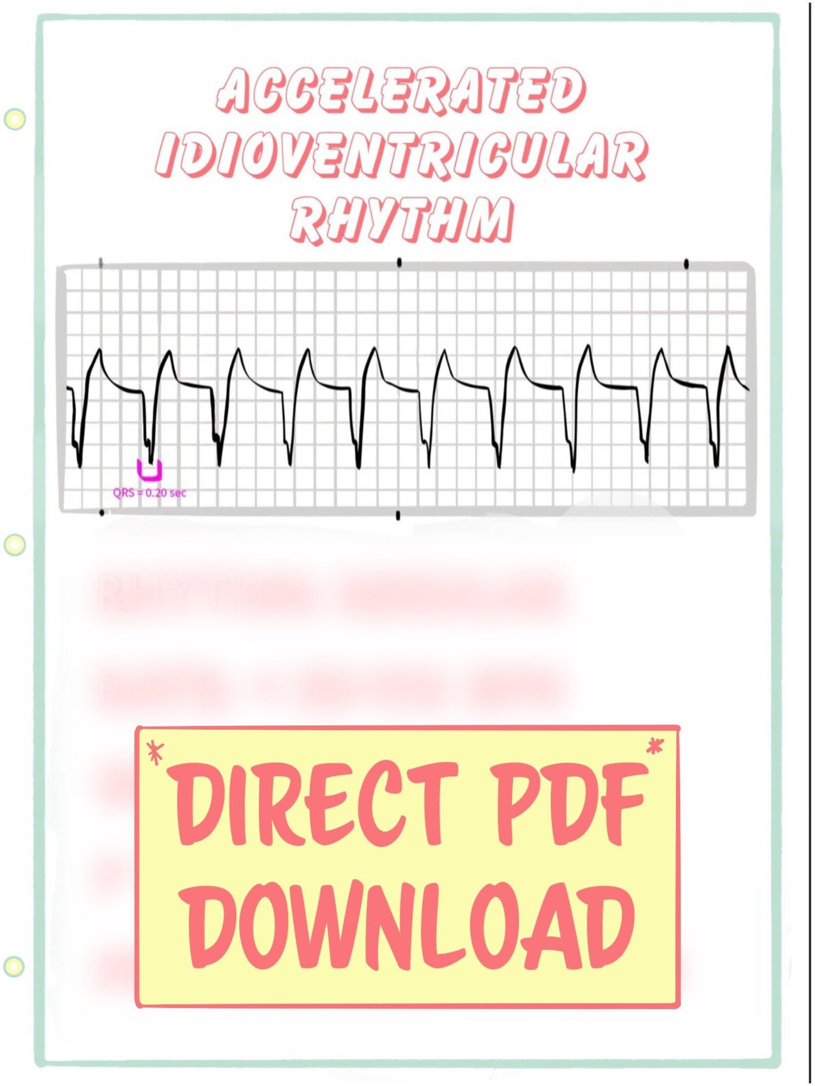 Accelerated Idioventricular Rhythm: PDF Pocket Guide - Etsy