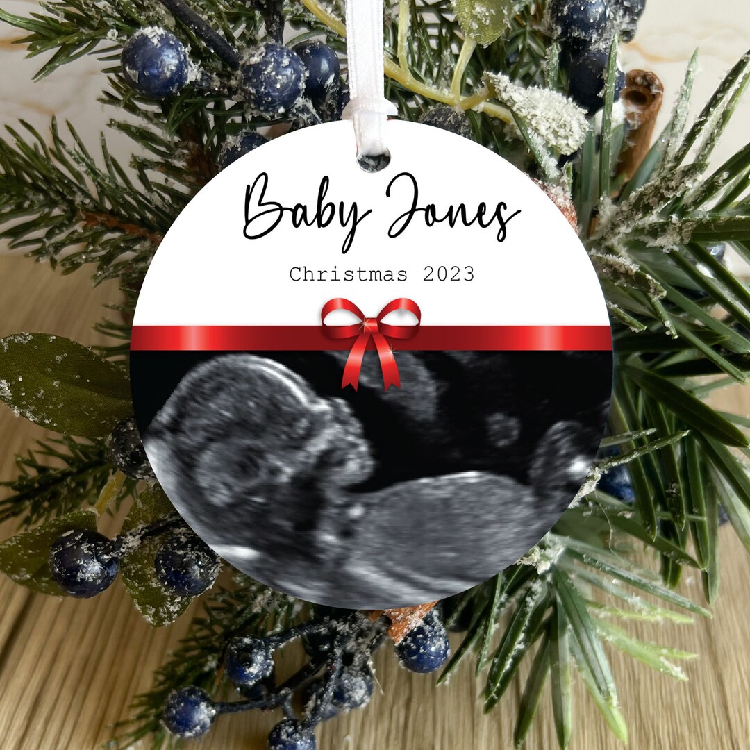 New Baby Scan Photo on Christmas Bauble, Ultrasound Scan Picture With ...
