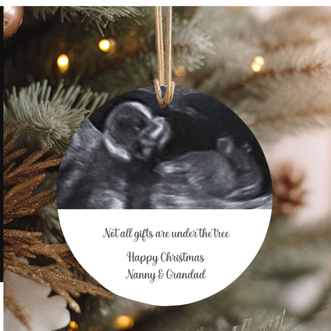 Personalisierte Baby Scan Bauble für Papa zu sein Weihnachtsgeschenk ...
