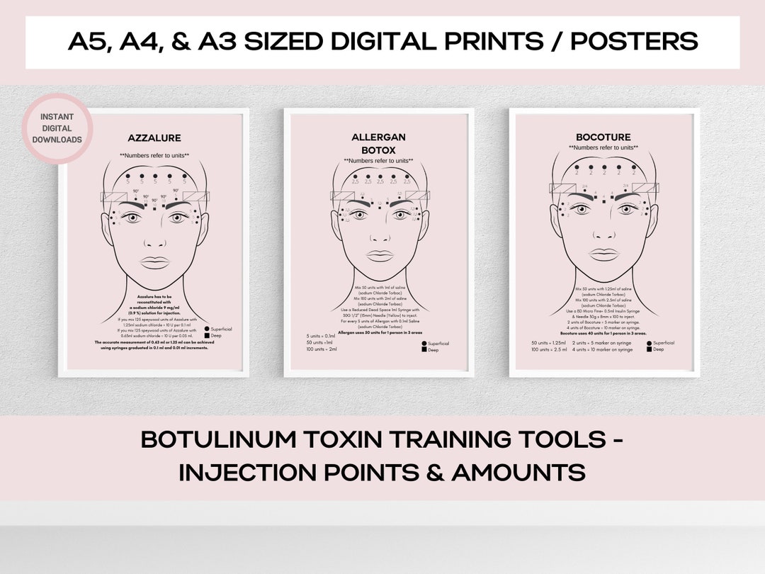 Botulinum Toxin Injection Training Prints/posters Guide for Injecting ...
