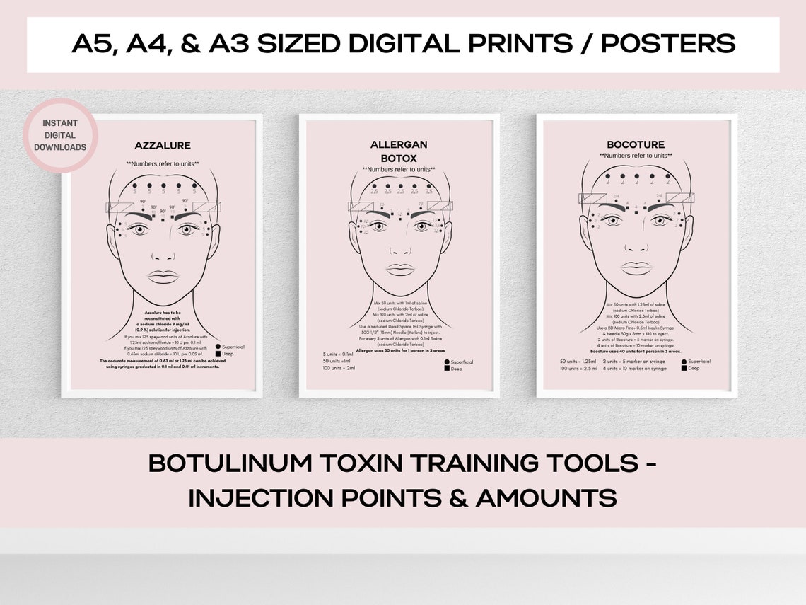 Botulinum Toxin Injection Training Prints/posters Guide for Injecting ...