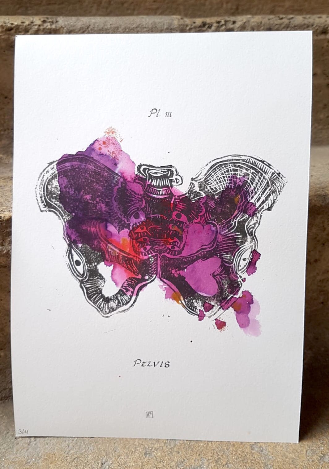 Linocut Pelvis Pelvis Anatomical Board - Etsy