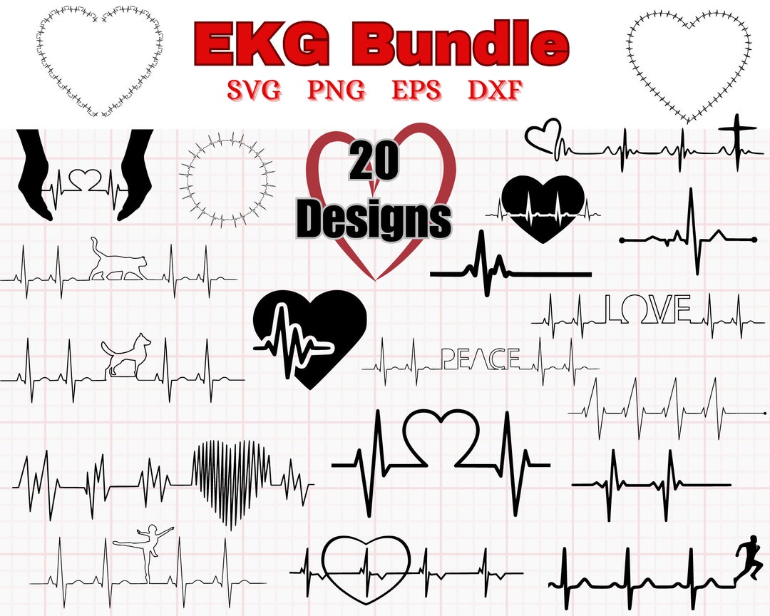 EKG/ECG Heart Rhythm Bundle - Etsy