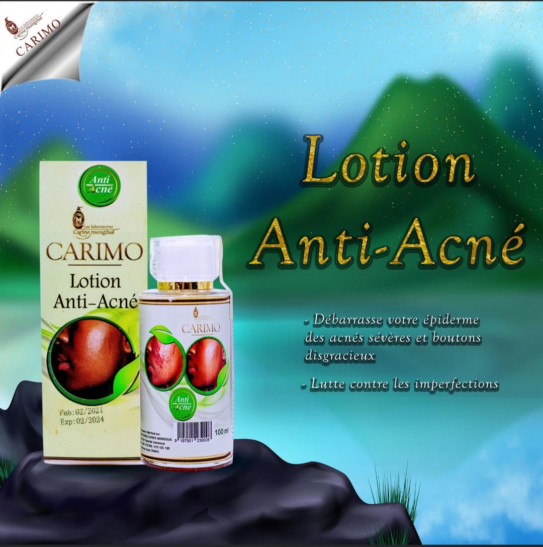 CARIMO Anti-acne Lotion - Etsy