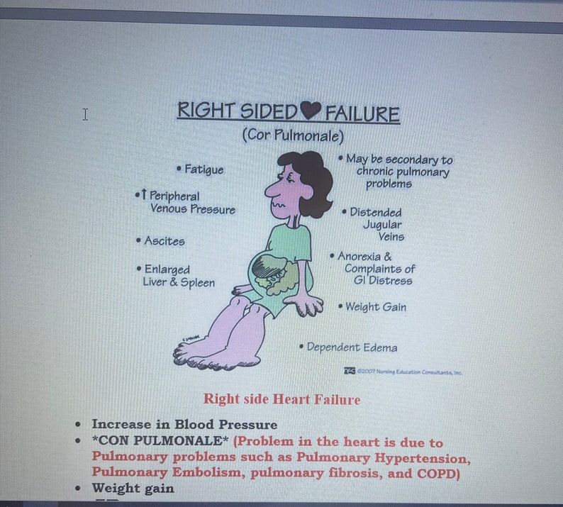 Heart Failure, Asthma, COPD Nursing School Notes - Etsy