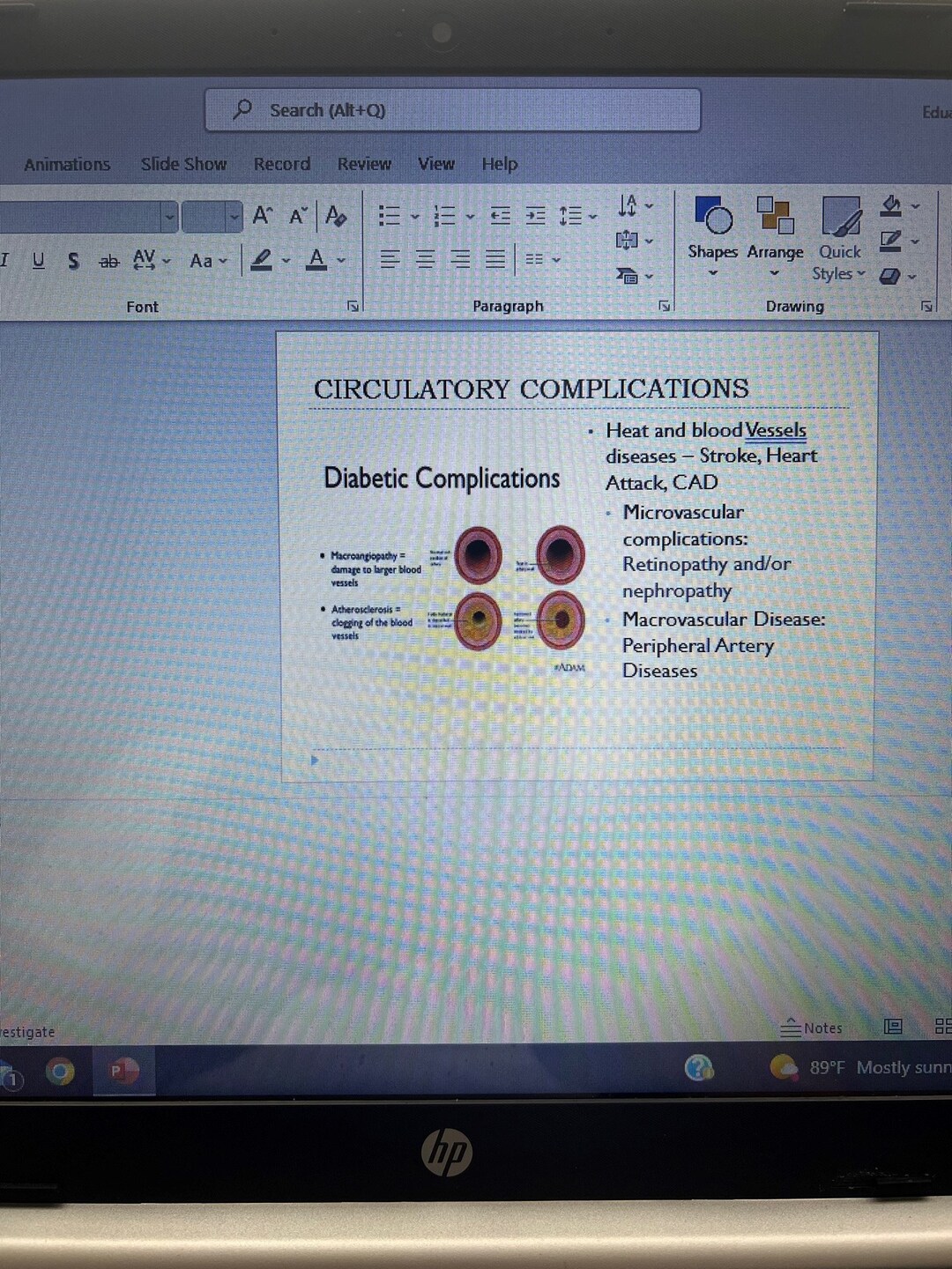 Diabetes for Nursing/ Nursing School Notes - Etsy