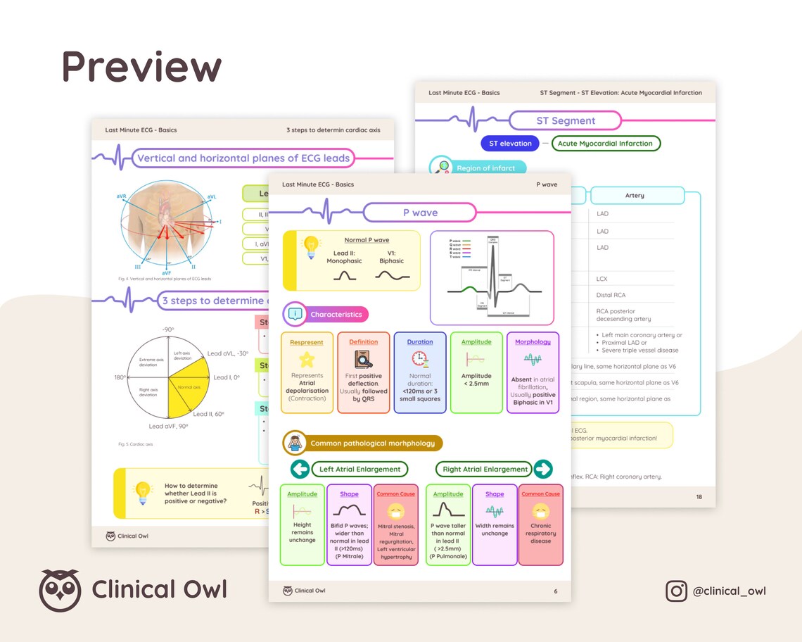 ECG Essentials | Last Minute Study Notes for Nursing, Medical, Pharmacy ...