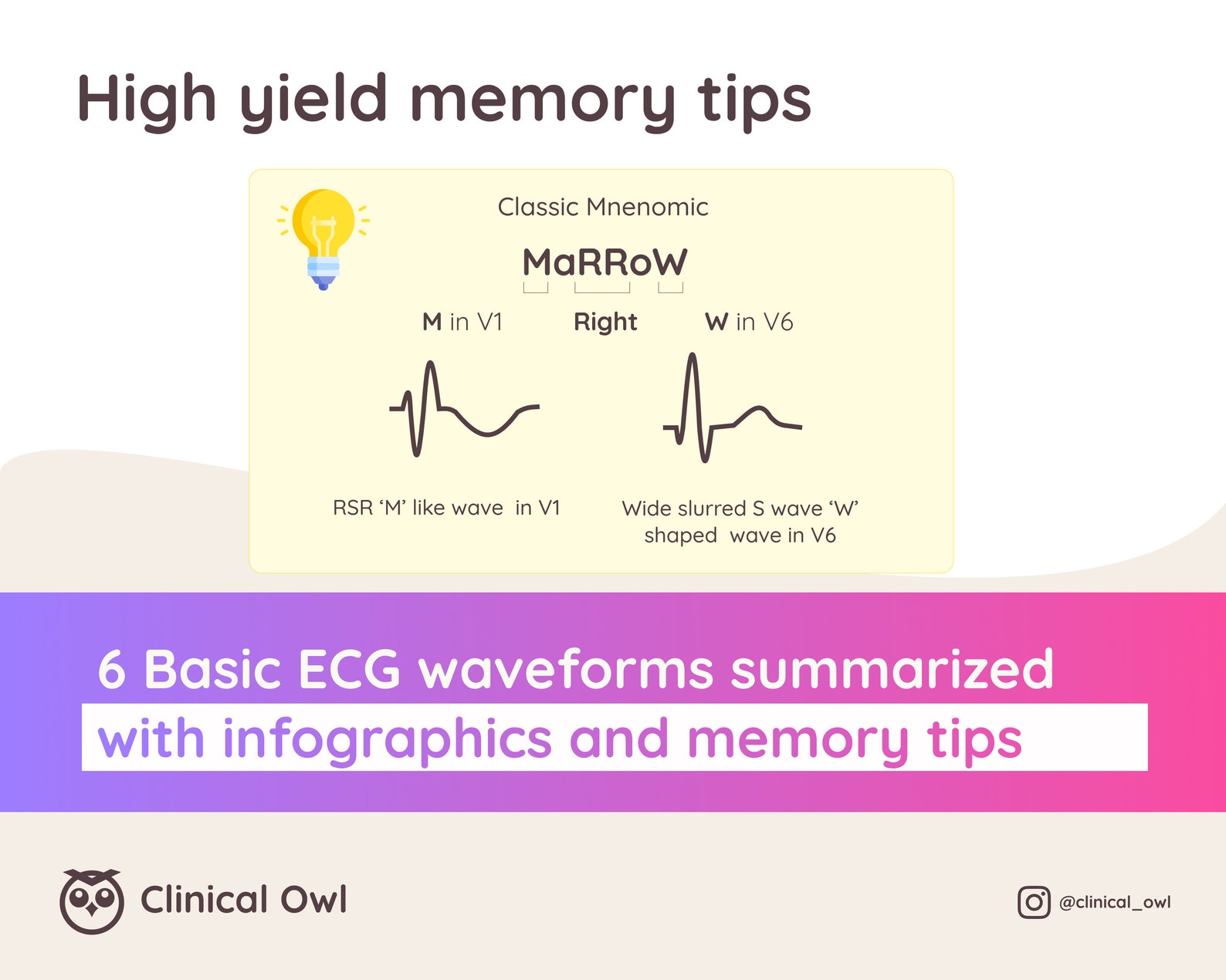 ECG Essentials | Last Minute Study Notes for Nursing, Medical, Pharmacy ...